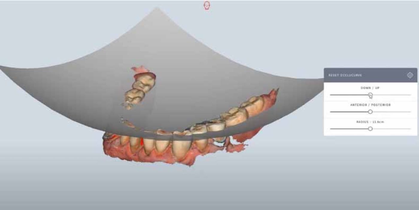 Modjaw™ - Occlucurve™, the 4D occlusal curve