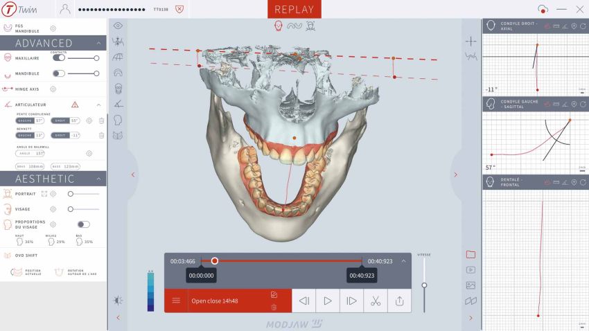 Modjaw™ - Access twim™