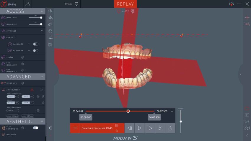 Modjaw™ - Access twim™
