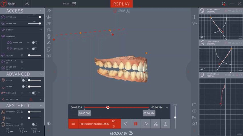 Modjaw™ - Advanced twim™